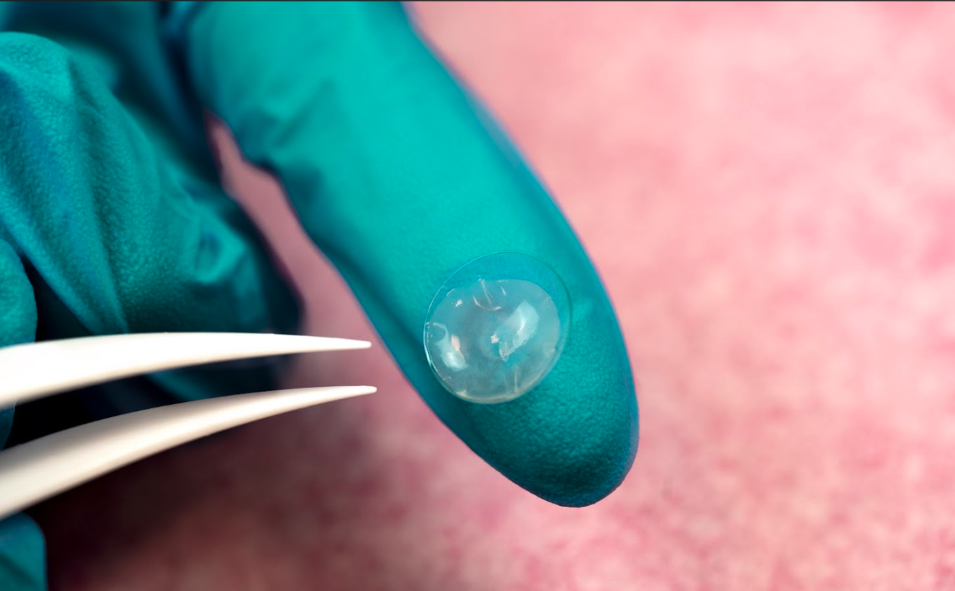 BioTissue Introduces CAM360 AmnioGraft: A Shelf-Stable Cryopreserved ...